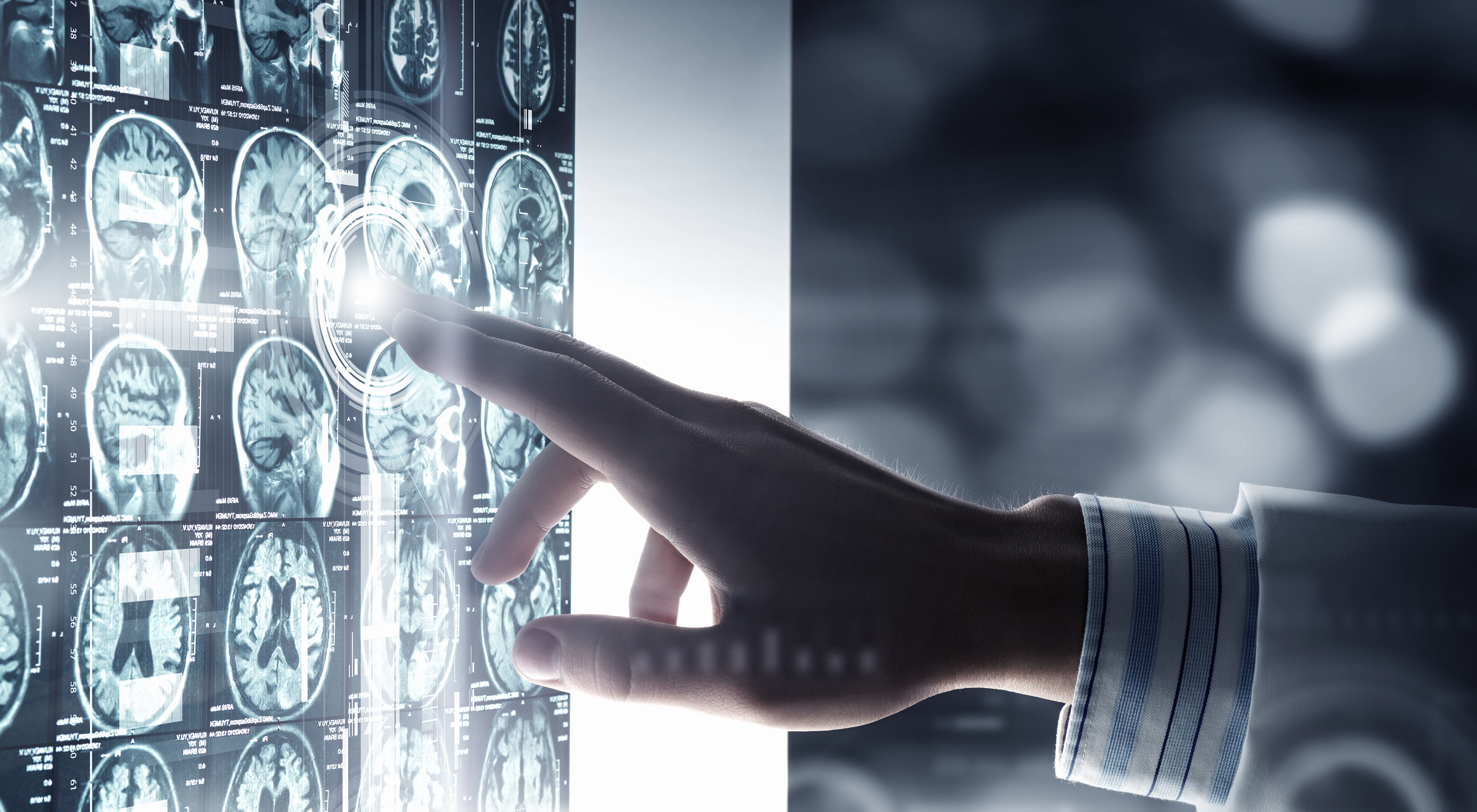 Neurostimulation - BVMed