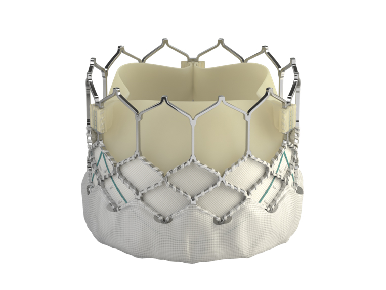 TAVI hat in Deutschland Herzklappen-Operation überholt - BVMed