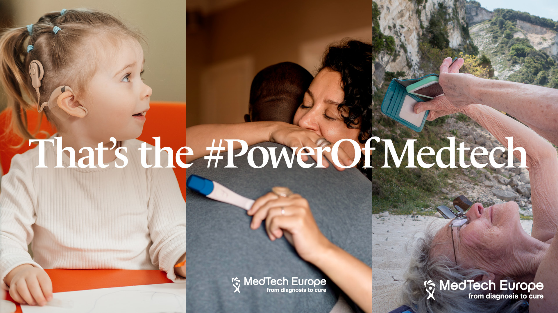 Tracheostoma und Beatmung - BVMed