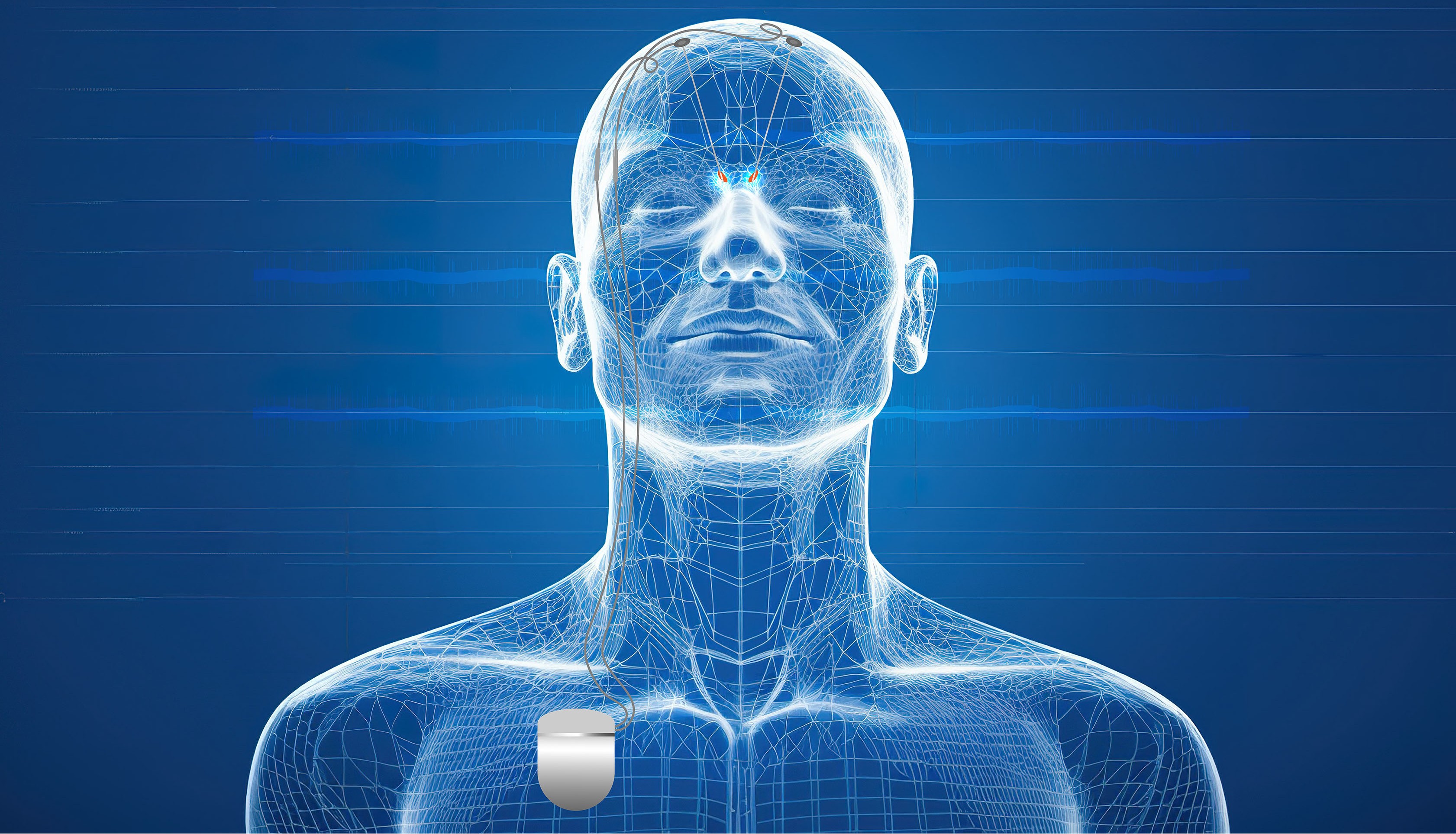 Verfahren der Neuromodulation und Neurostimulation - BVMed